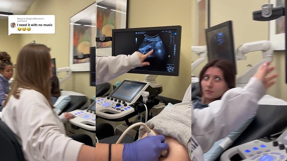 Toto je tvoja pečeň, žlčník, žalúdok, maternica. A toto je čo? - Mojevideo